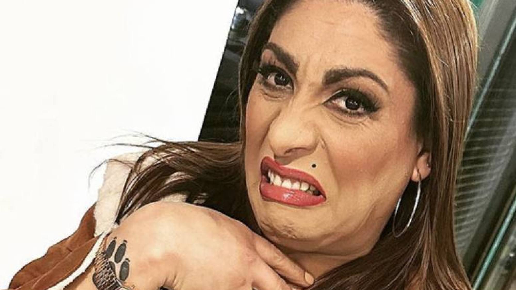 Botota Fox se hizo tratamiento estético que cambió su vida